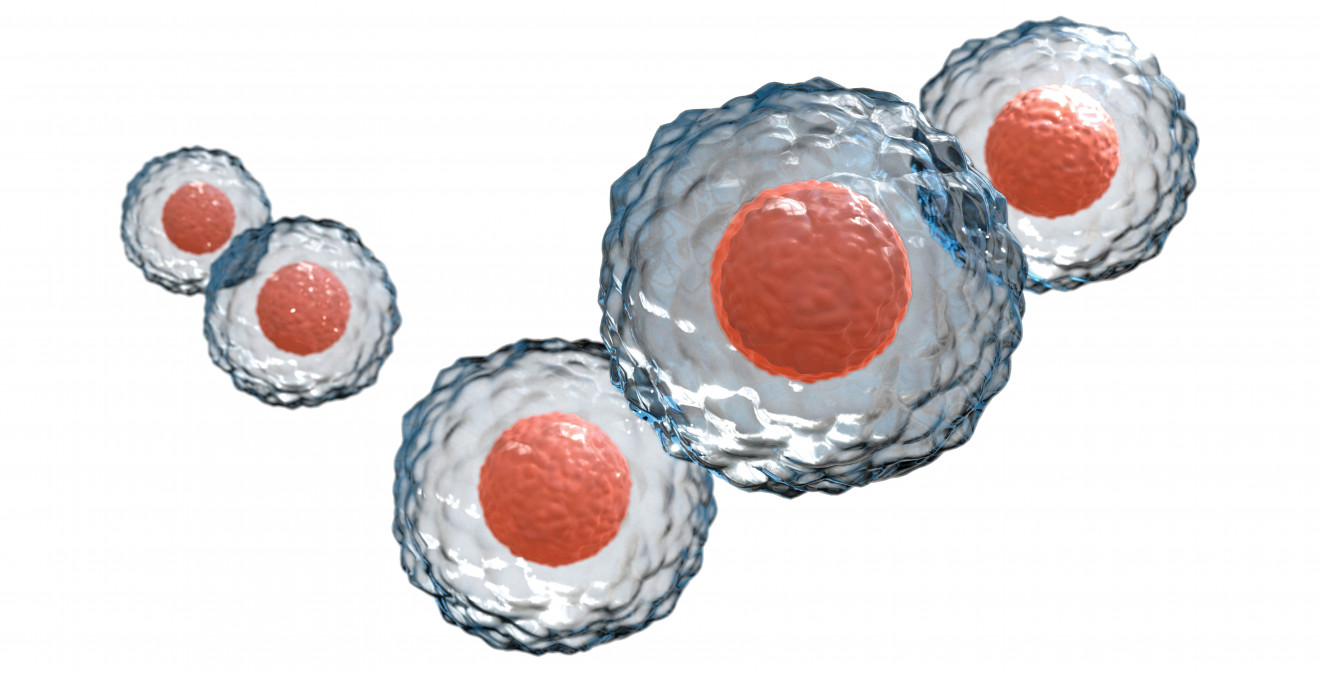 Stem Cell Transplant Offers No Additional Benefit for Mantle Cell ...